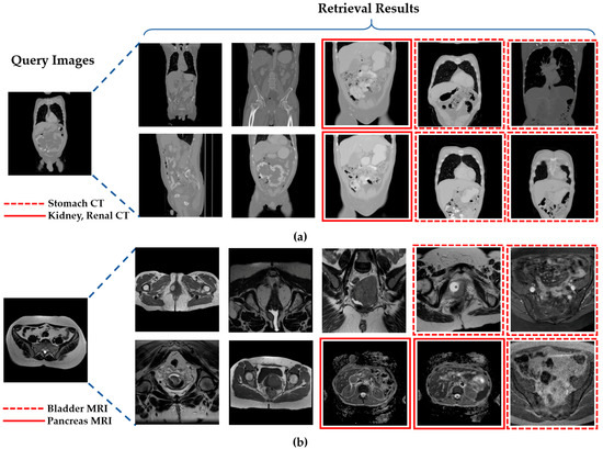 Jcm Free Full Text Effective Diagnosis And Treatment Through Content Based Medical Image