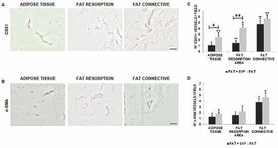 Engineered Fat Graft Enhanced with Adipose-Derived Stromal Vascular ...