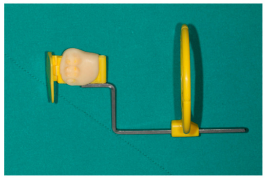 Comparative Study between an Immediate Loading Protocol Using the ...