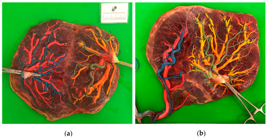 JCM | Special Issue : Diagnosis, Treatment and Outcome in Complicated ...