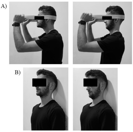 Motor Imagery and Action Observation of Specific Neck Therapeutic ...