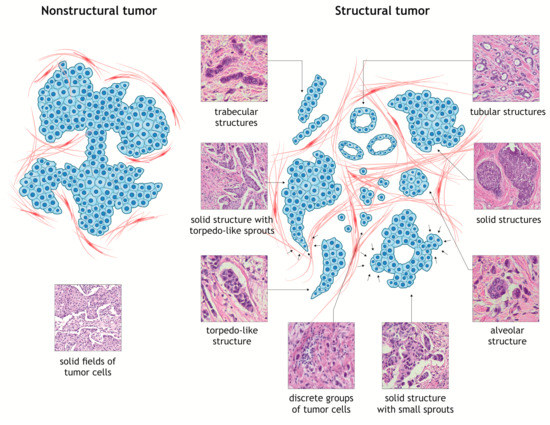 Markers of Cancer Cell Invasion: Are They Good Enough?