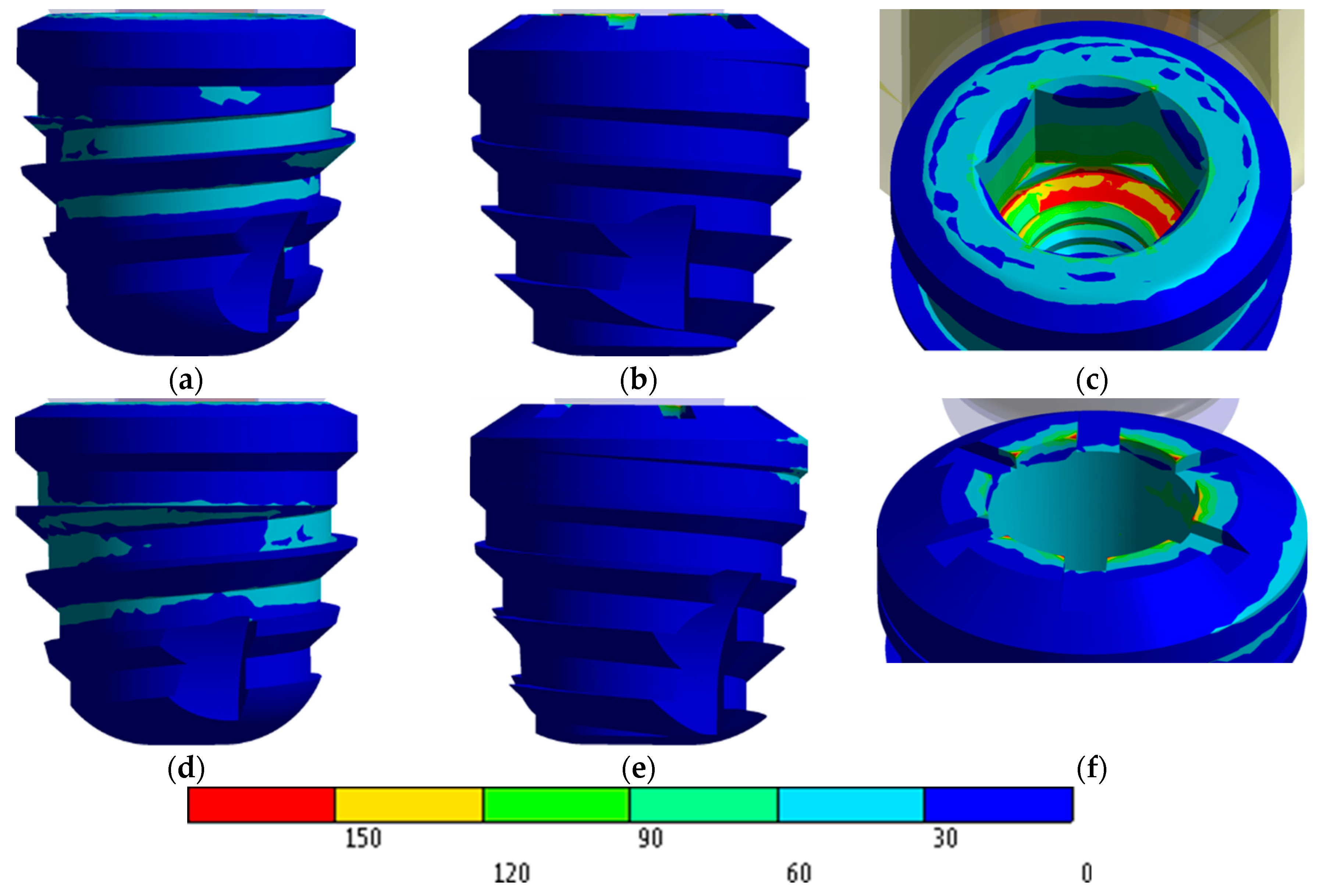 A Finite Element Analysis to Compare Stress Distribution on Extra-Short Implants with Two ...