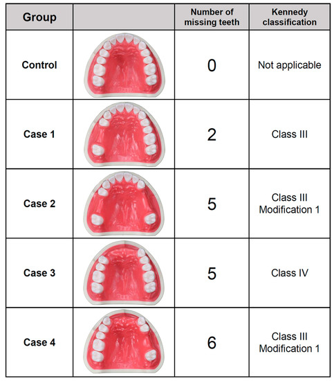 Repeatability of Intraoral Scanners for Complete Arch Scan of Partially ...