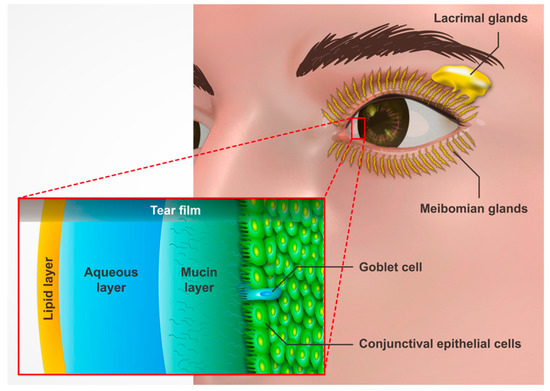 Dry Eye Disease: A Review of Epidemiology in Taiwan, and its Clinical ...