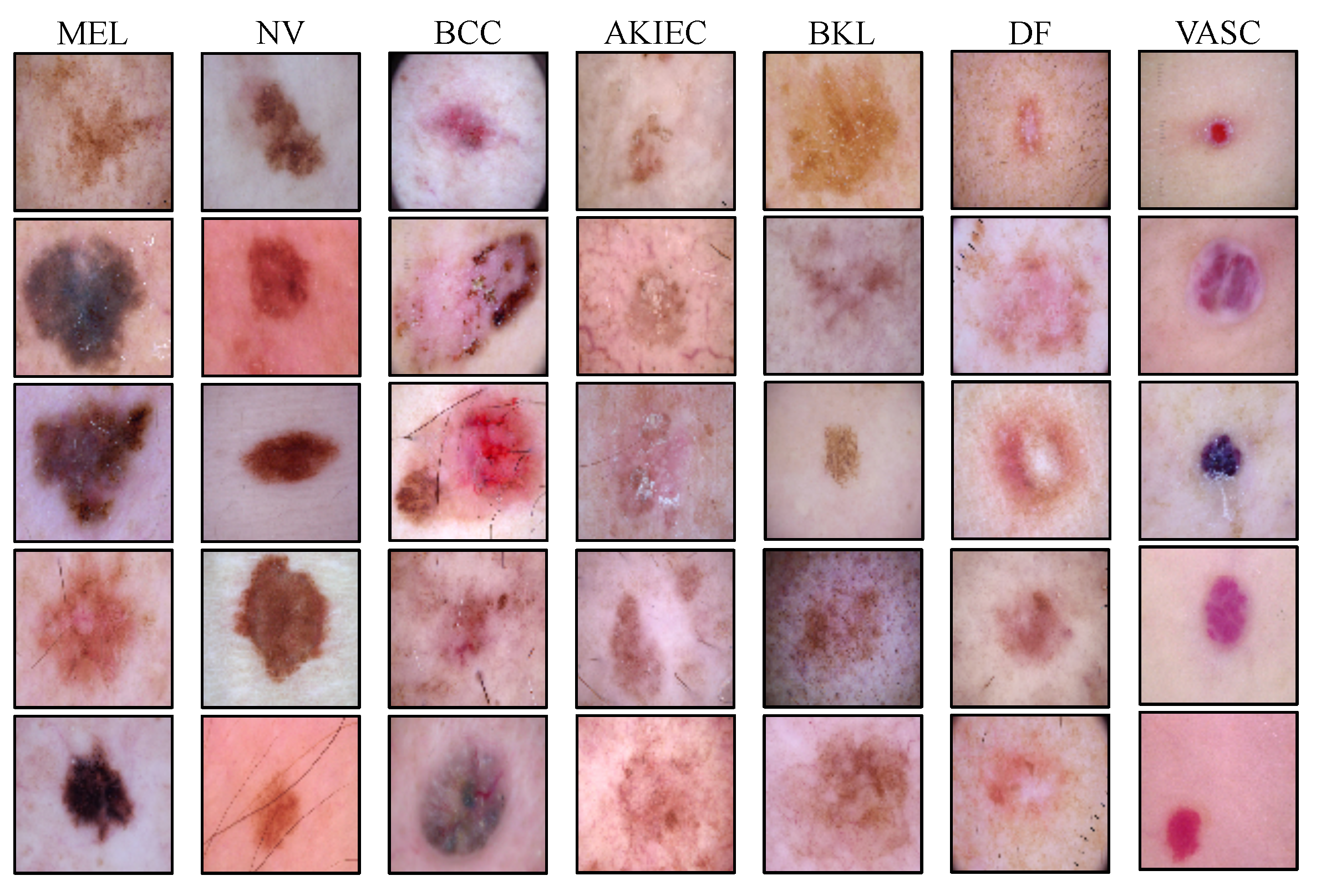Risk-Aware Machine Learning Classifier for Skin Lesion Diagnosis