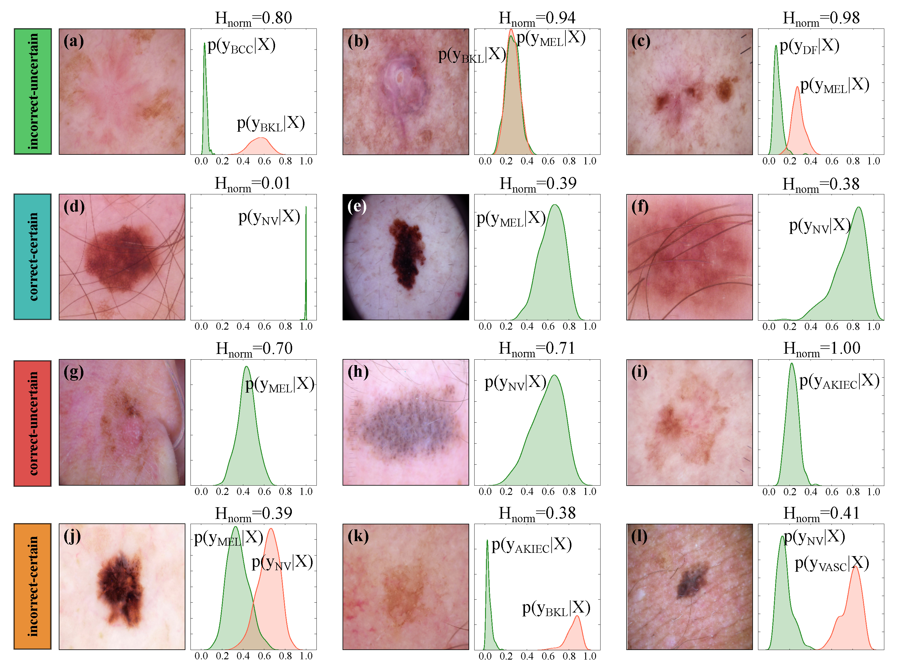 Risk-Aware Machine Learning Classifier for Skin Lesion Diagnosis