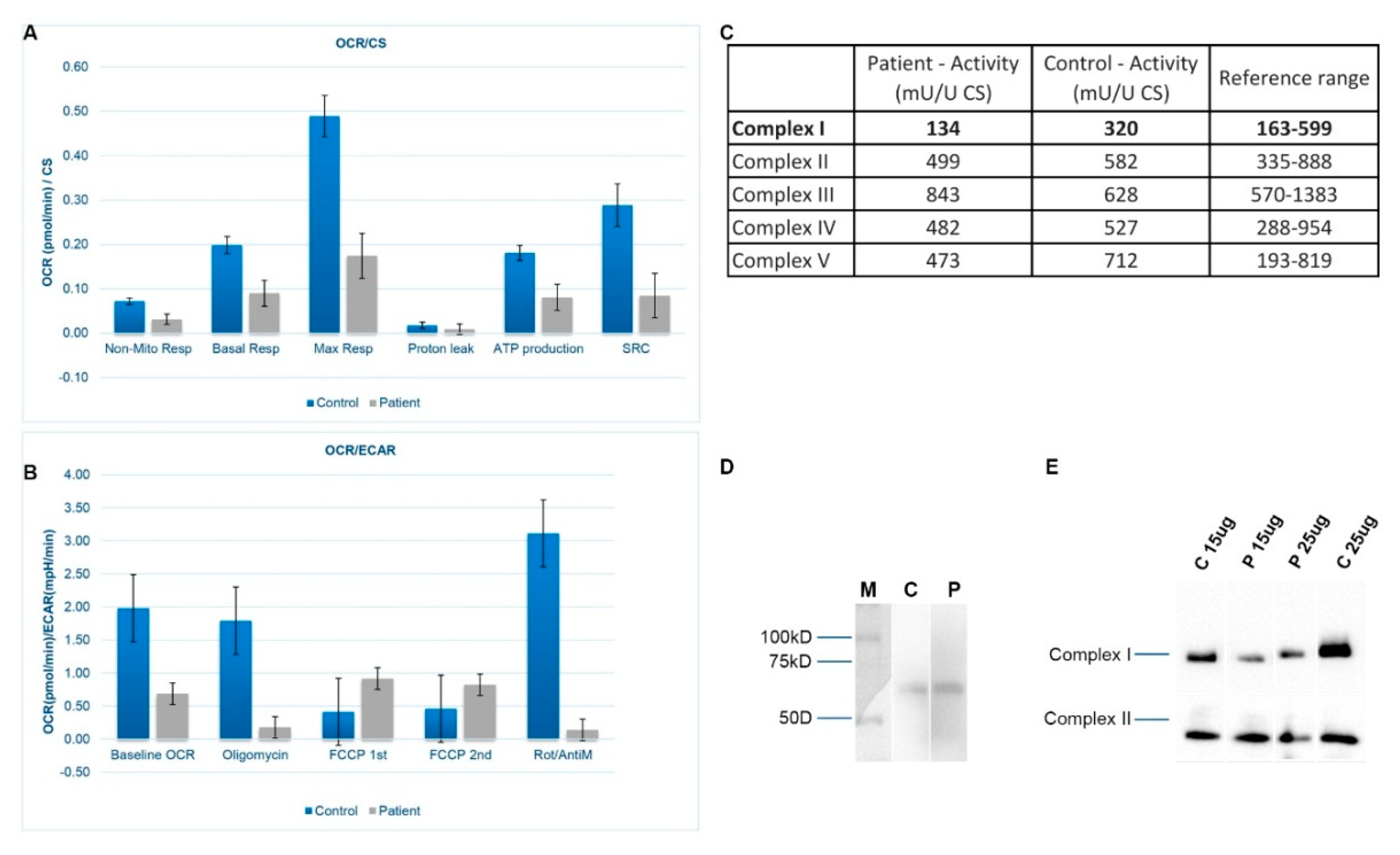 Identification and Characterization of New Variants in FOXRED1 Gene ...
