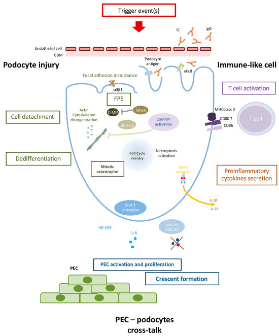 Podocyte Injury in Lupus Nephritis