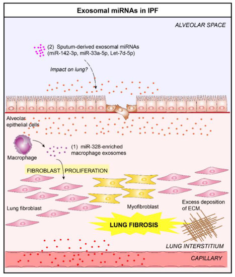 JCM | Special Issue : The New Frontier in Pulmonary Fibrosis