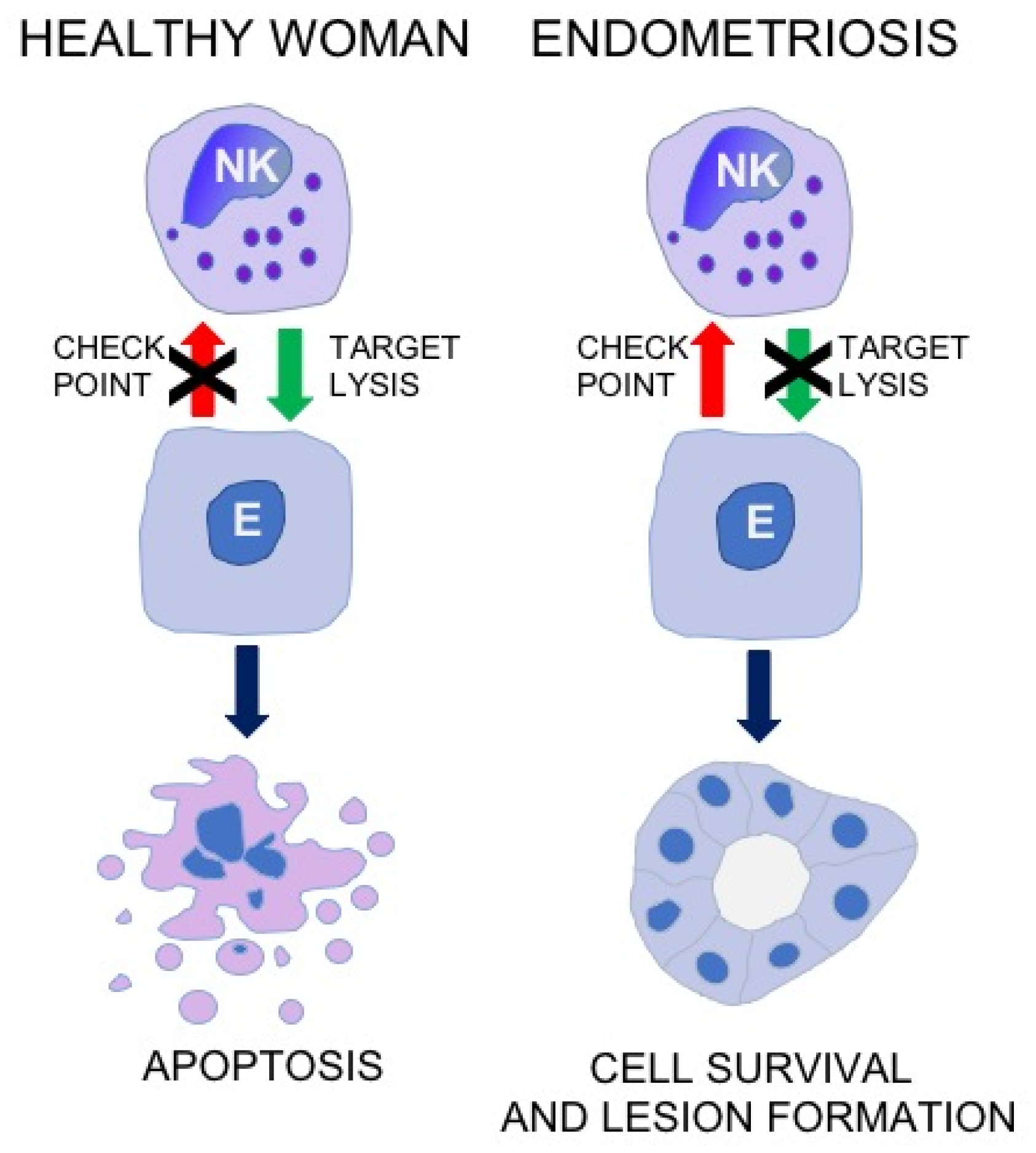 NK Cells as Potential Targets for Immunotherapy in Endometriosis