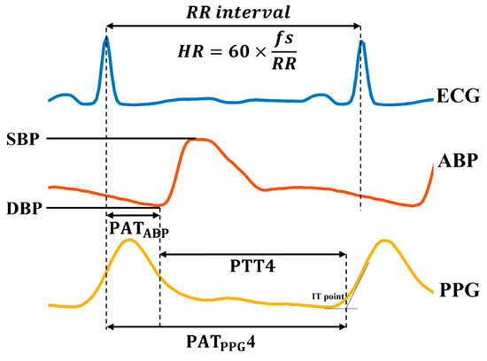 JCM | Free Full-Text | Analysis of Pulse Arrival Time as an Indicator ...