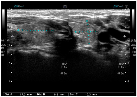 Correlations between Molecular Landscape and Sonographic Image of ...
