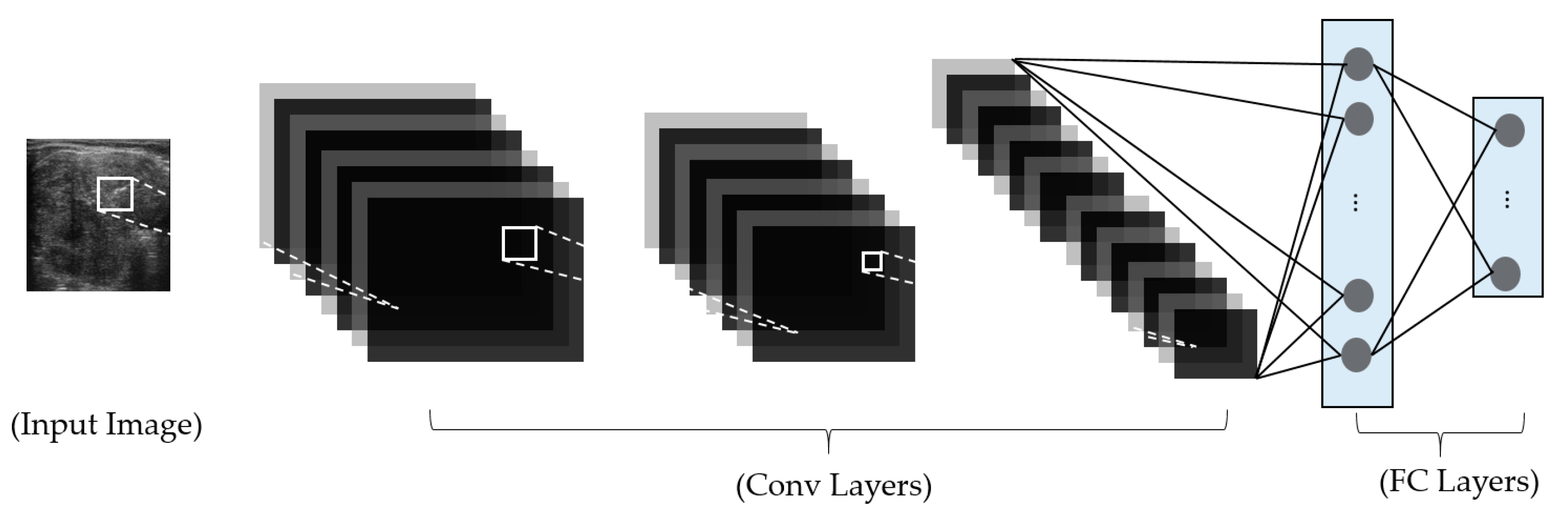 Artificial Intelligence-Based Thyroid Nodule Classification Using Information from Spatial and ...