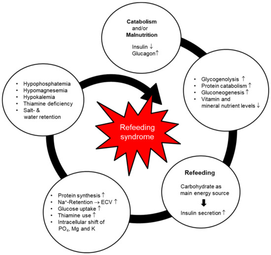 Management of Refeeding Syndrome in Medical Inpatients