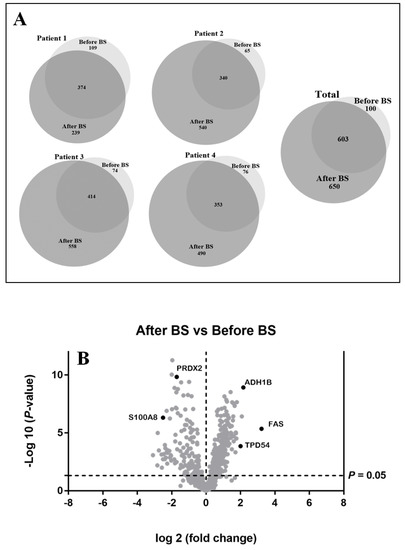 Jcm Free Full Text Beneficial Effects Of Bariatric Surgery Induced