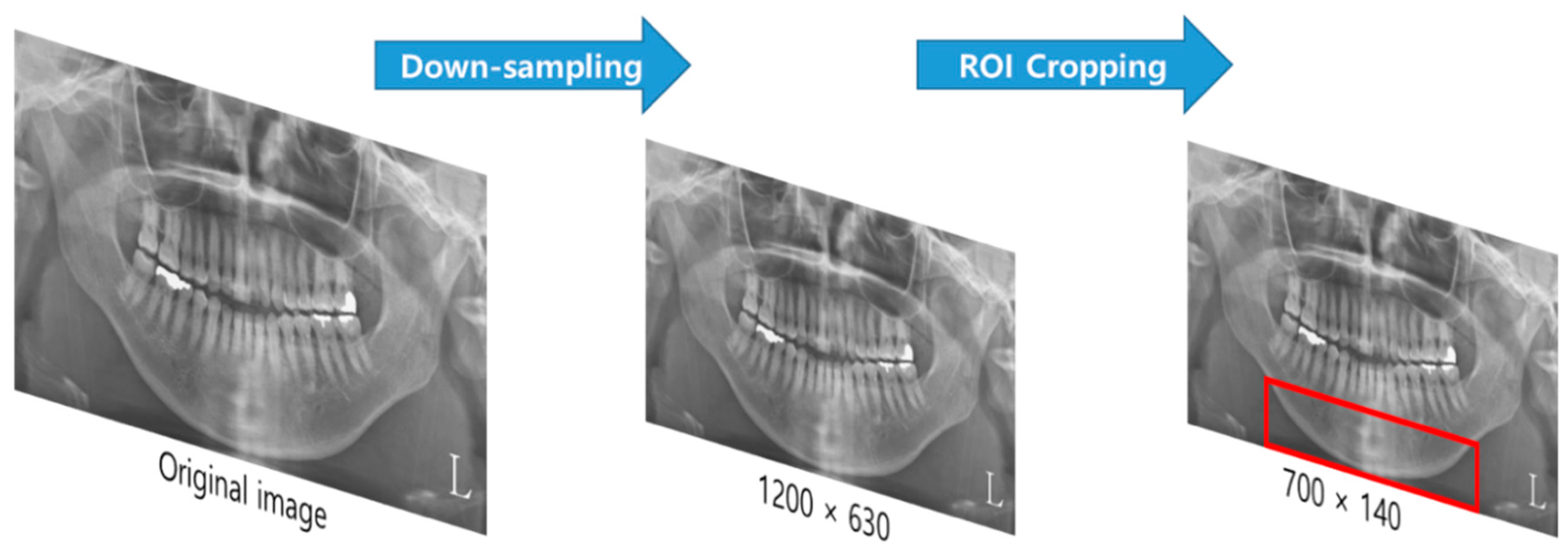 Evaluation of Transfer Learning with Deep Convolutional Neural Networks for Screening ...