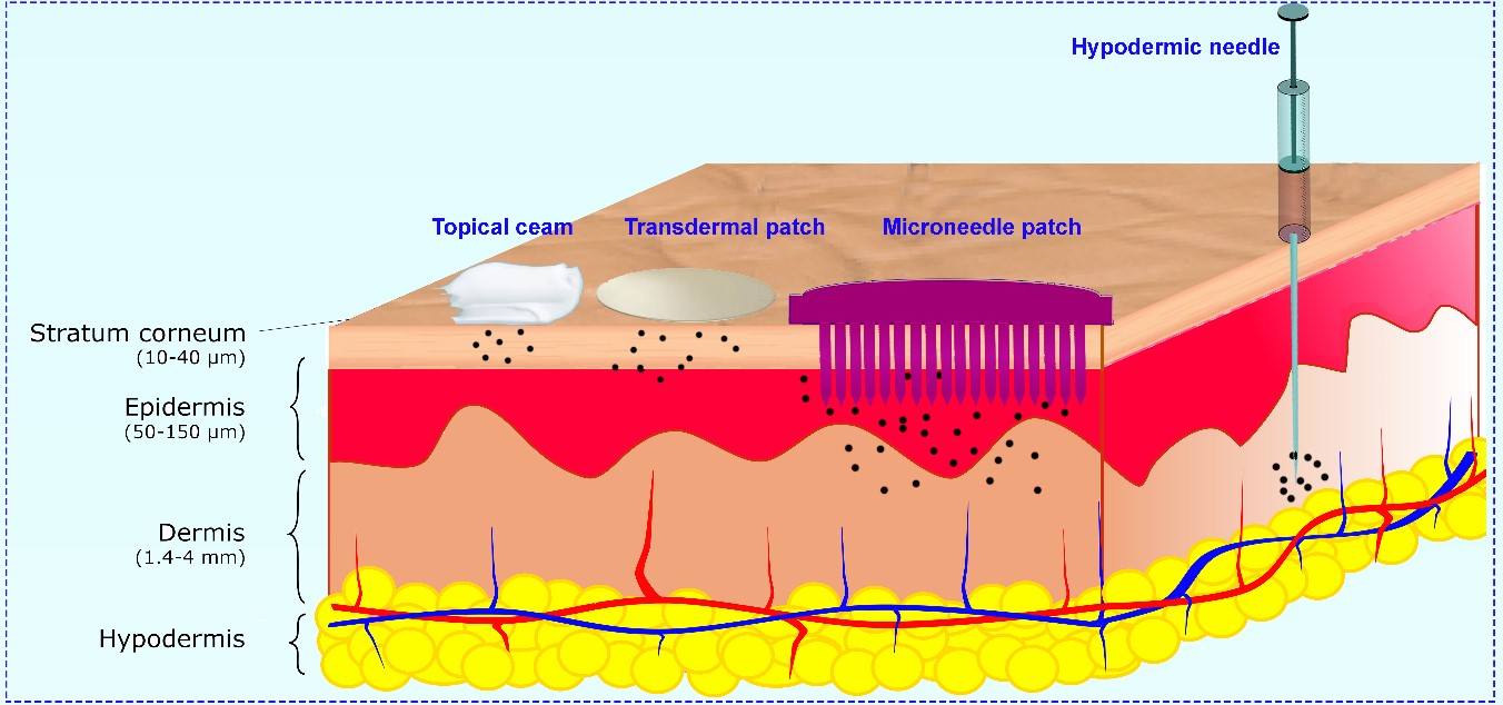 JCM | Free Full-Text | Progress in Microneedle-Mediated Protein Delivery