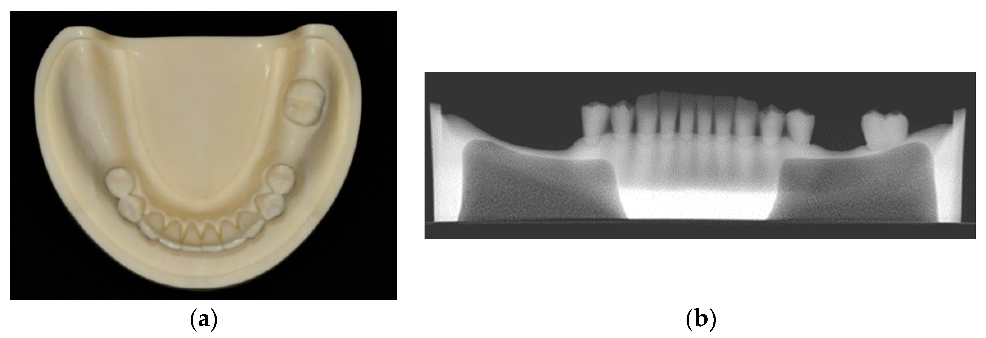 JCM | Free Full-Text | Stereolithographic Surgical Guide with a ...