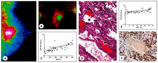 Breast-Specific Gamma Imaging with [99mTc]Tc-Sestamibi: An In Vivo ...