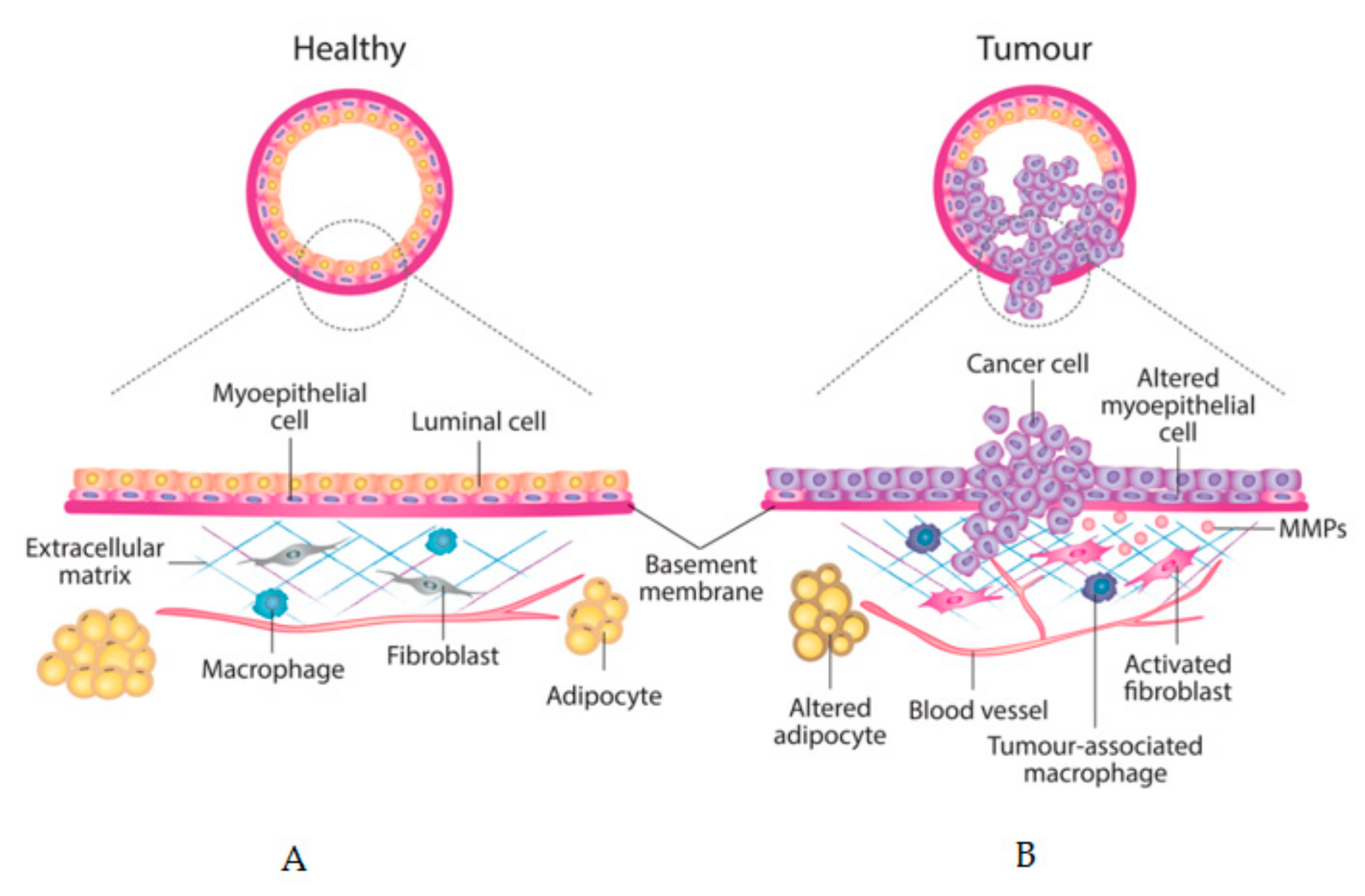 Jcm Free Full Text Breast Mammographic Density Stromal