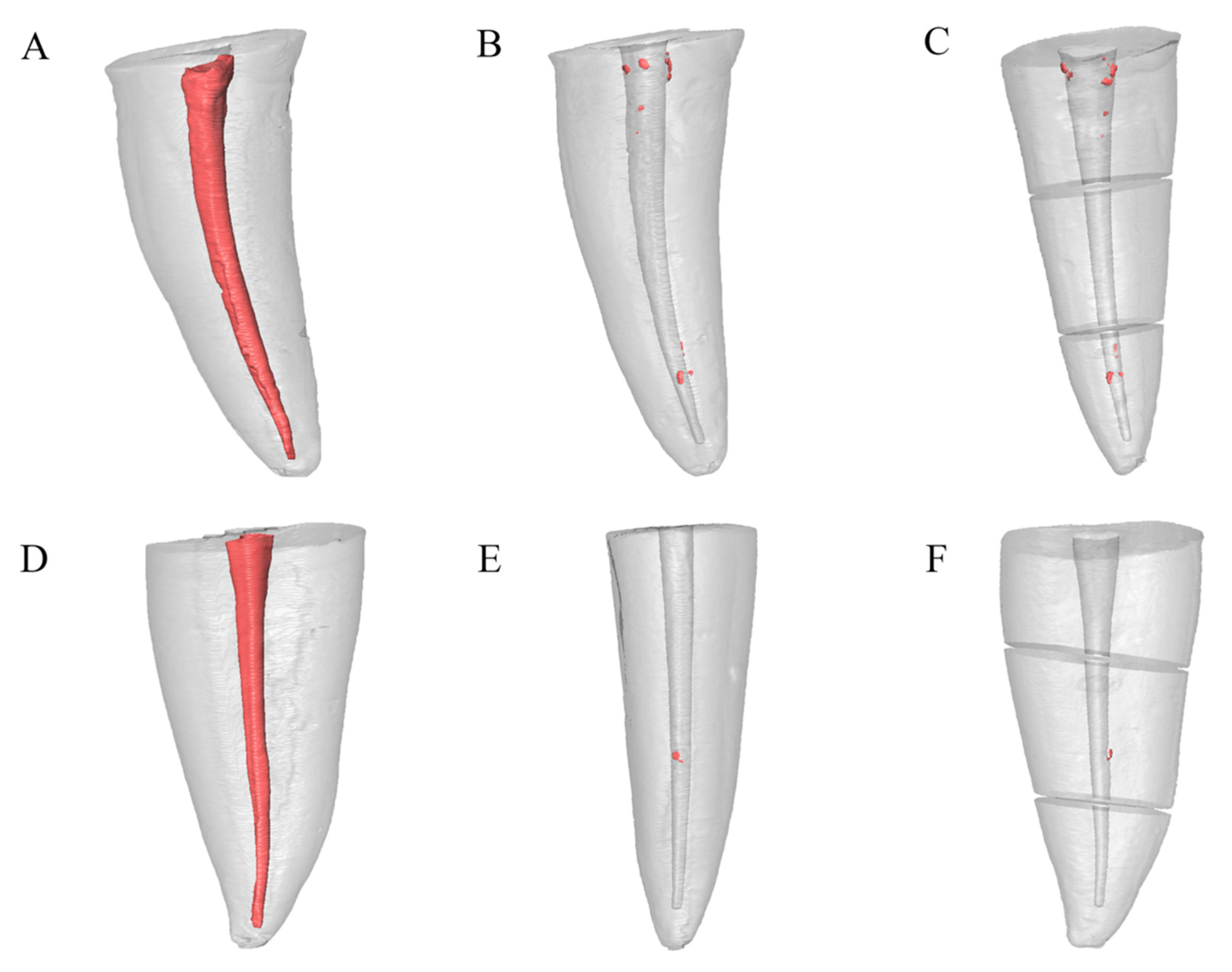 Comparison of Obturation Removal Efficiency from Straight Root Canals ...