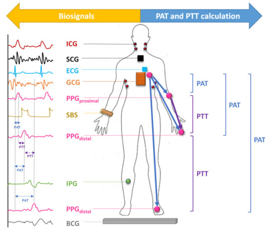 Multimodal Photoplethysmography-Based Approaches for Improved Detection ...