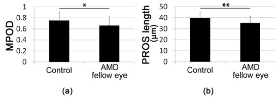 Macular Pigment Optical Density and Photoreceptor Outer Segment Length ...