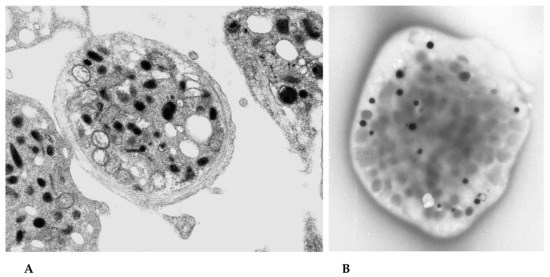 JCM | Free Full-Text | A Morphometric Analysis of Platelet Dense ...