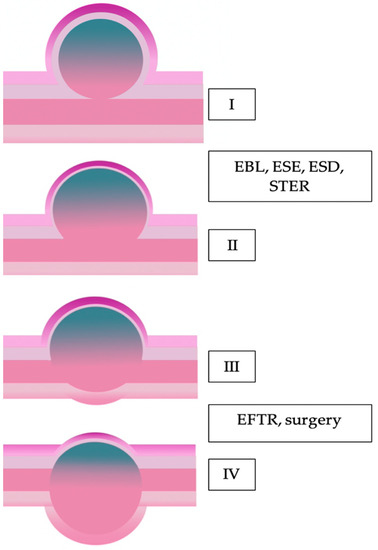 Optimal Endoscopic Resection Technique for Selected Gastric GISTs. The ...