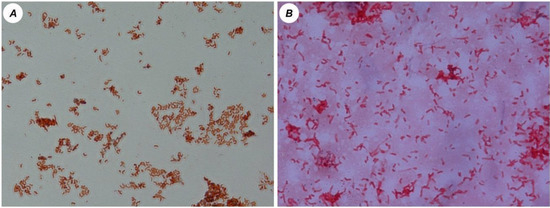 Enterobacter Aerogenes Gram Stain