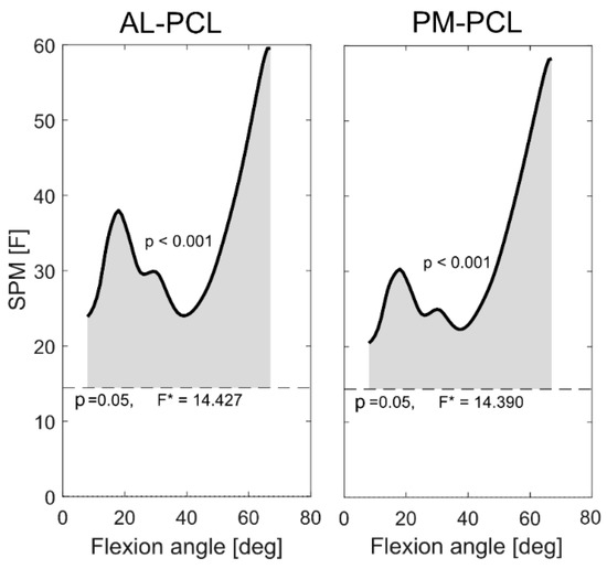 Elongation Patterns of the Posterior Cruciate Ligament after Total Knee ...