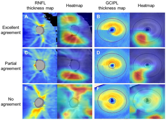JCM | Free Full-Text | Development and Validation of a Deep Learning ...