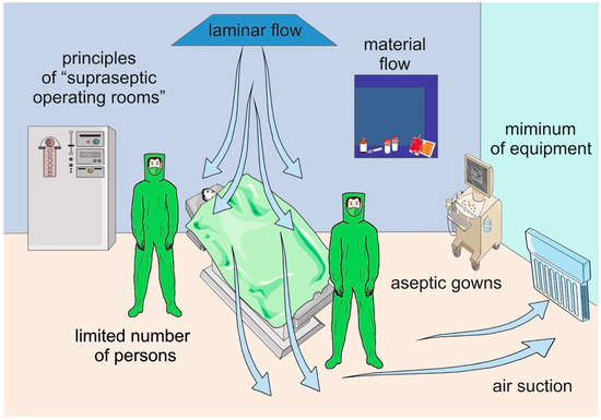 Prevention of Prosthetic Joint Infection: From Traditional Approaches ...