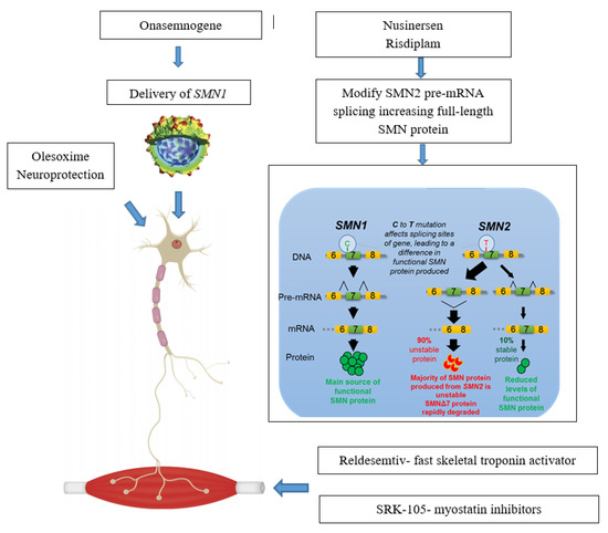 New Treatments in Spinal Muscular Atrophy: Positive Results and New ...