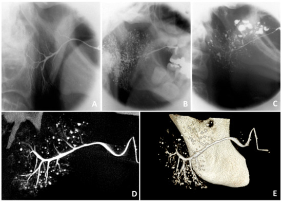 Imaging in Primary Sjögren’s Syndrome