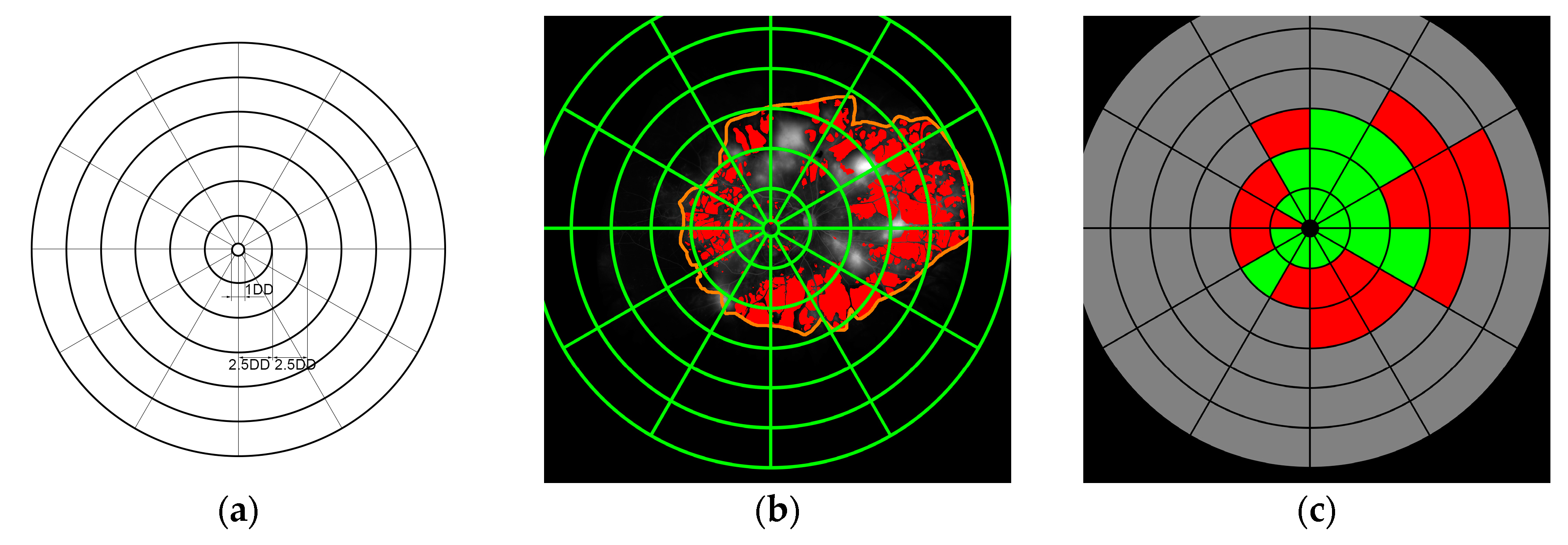 Deep Learning-Based Segmentation and Quantification of Retinal ...