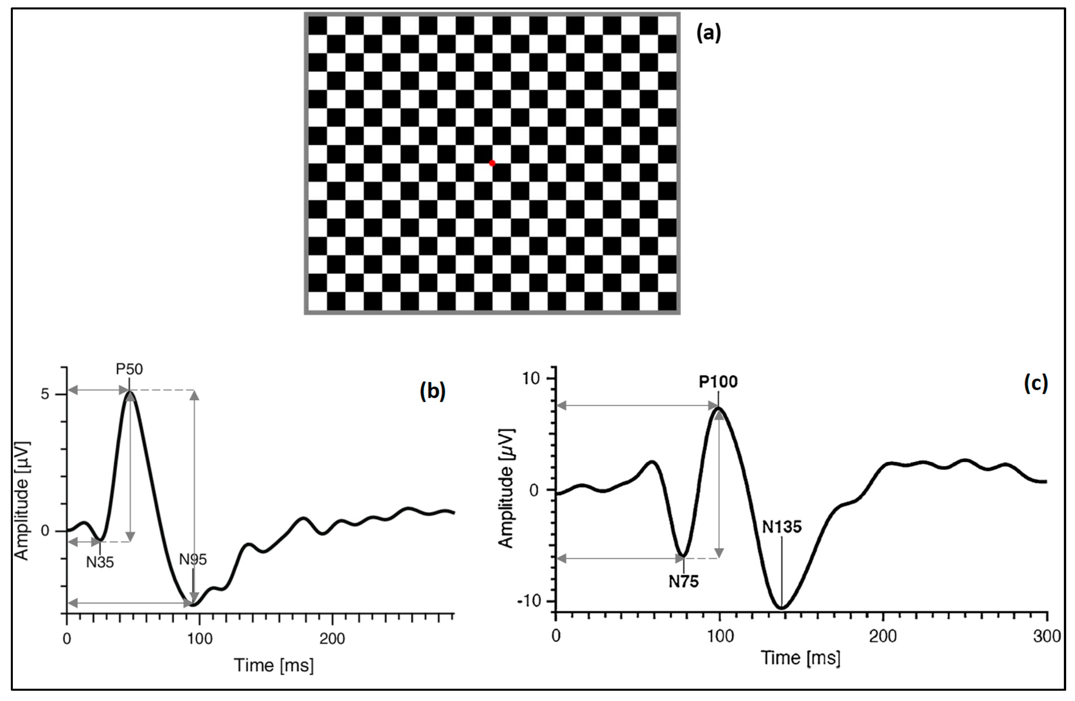 JCM | Free Full-Text | Retinal Response of Low Myopes during ...
