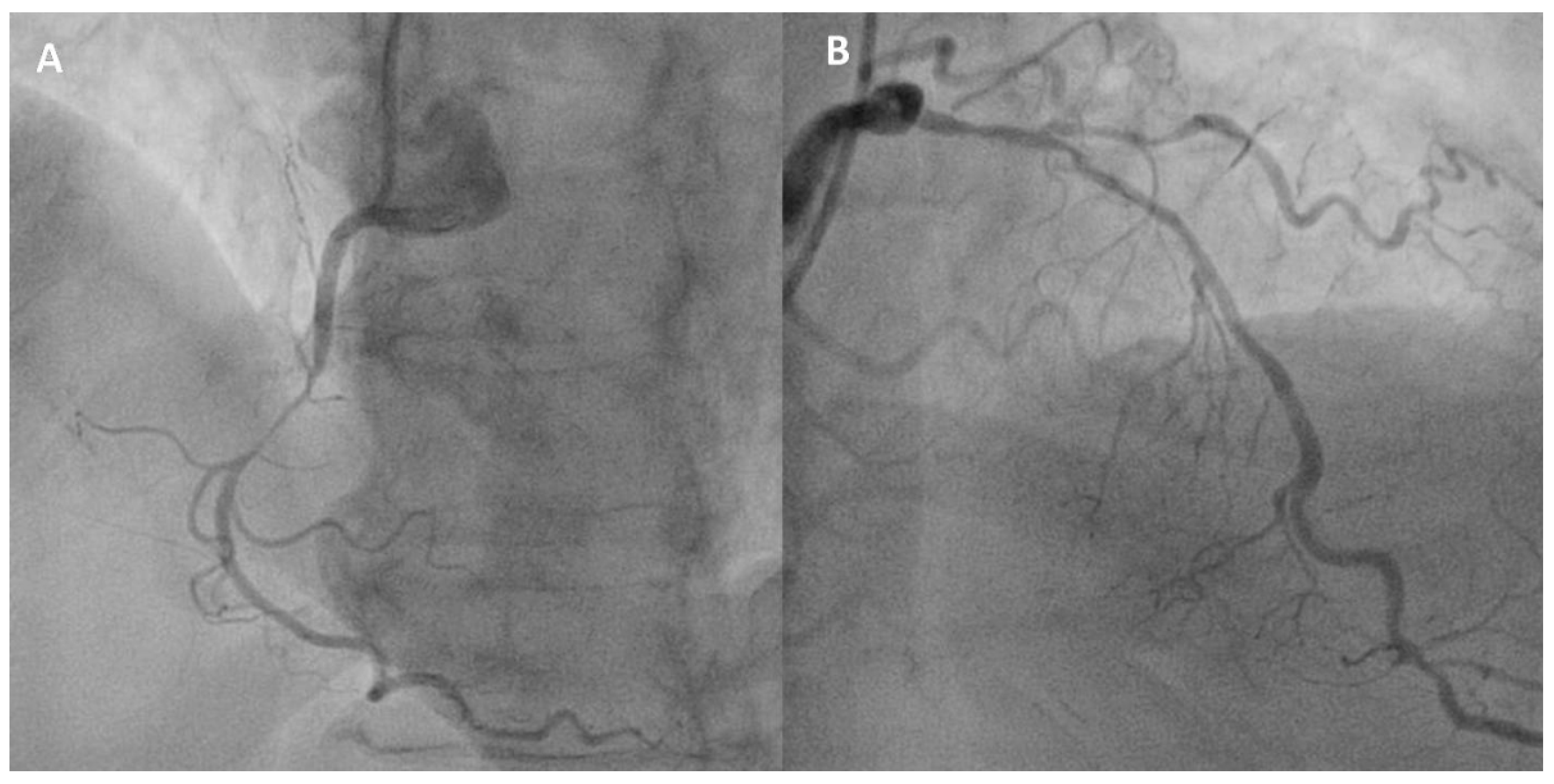 Jcm Free Full Text Optimal Antithrombotic Treatment Of Patients