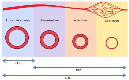 Coronary Microvascular Dysfunction