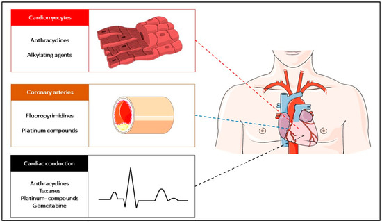 Jcm Free Full Text Management Of Cardiac Toxicity Induced By