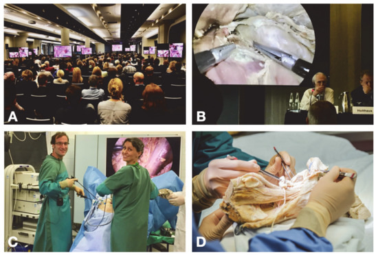 Didactic Benefits of Surgery on Body Donors during Live Surgery Events ...
