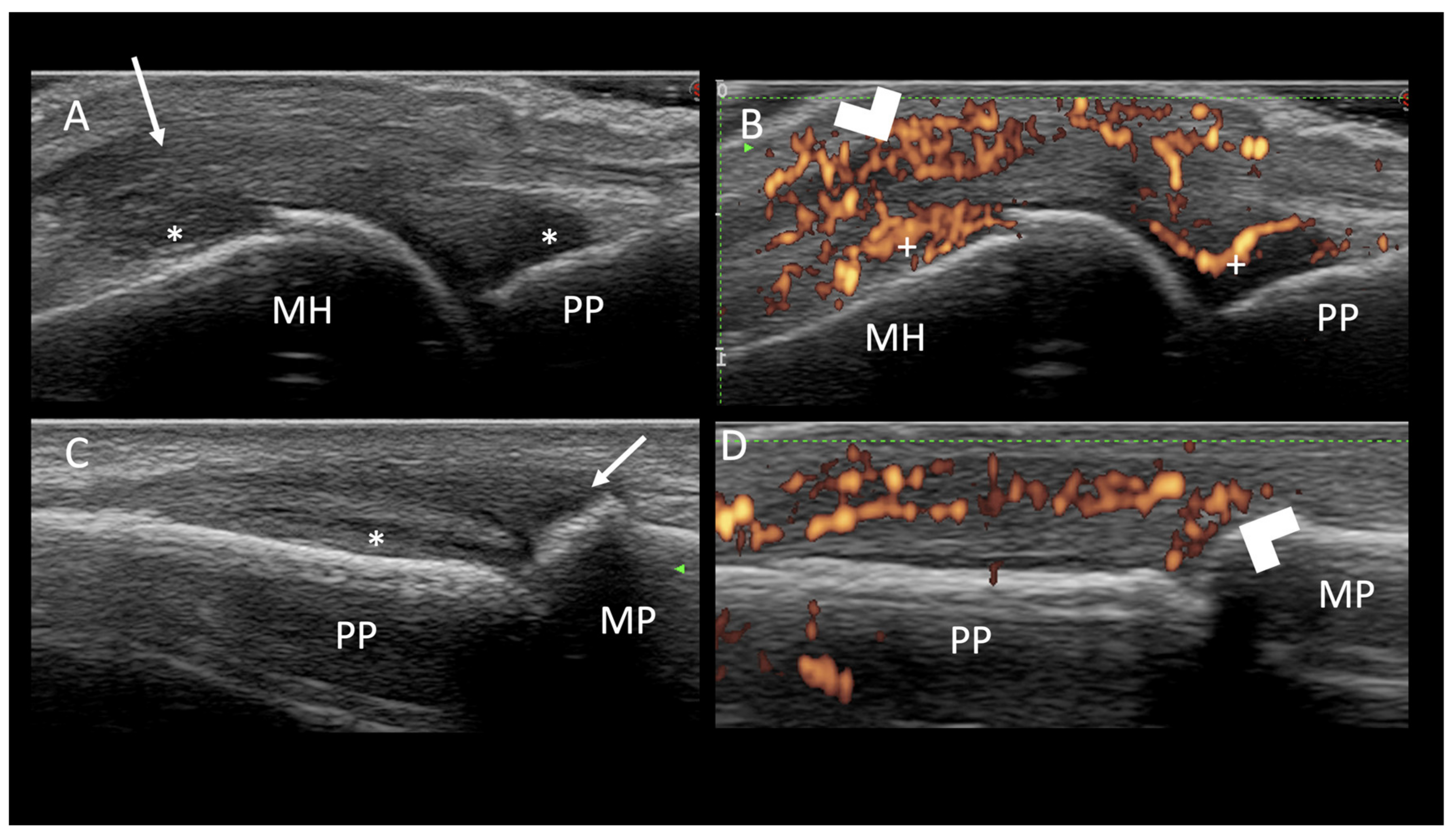 Jcm Free Full Text Accuracy Of Physical Examination To Detect