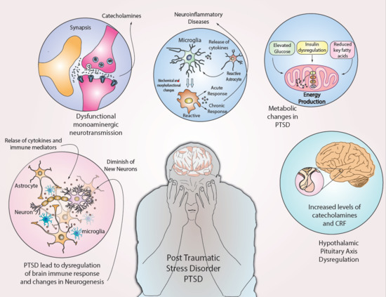 JCM | Free Full-Text | Neurophysiology and Psychopathology Underlying ...
