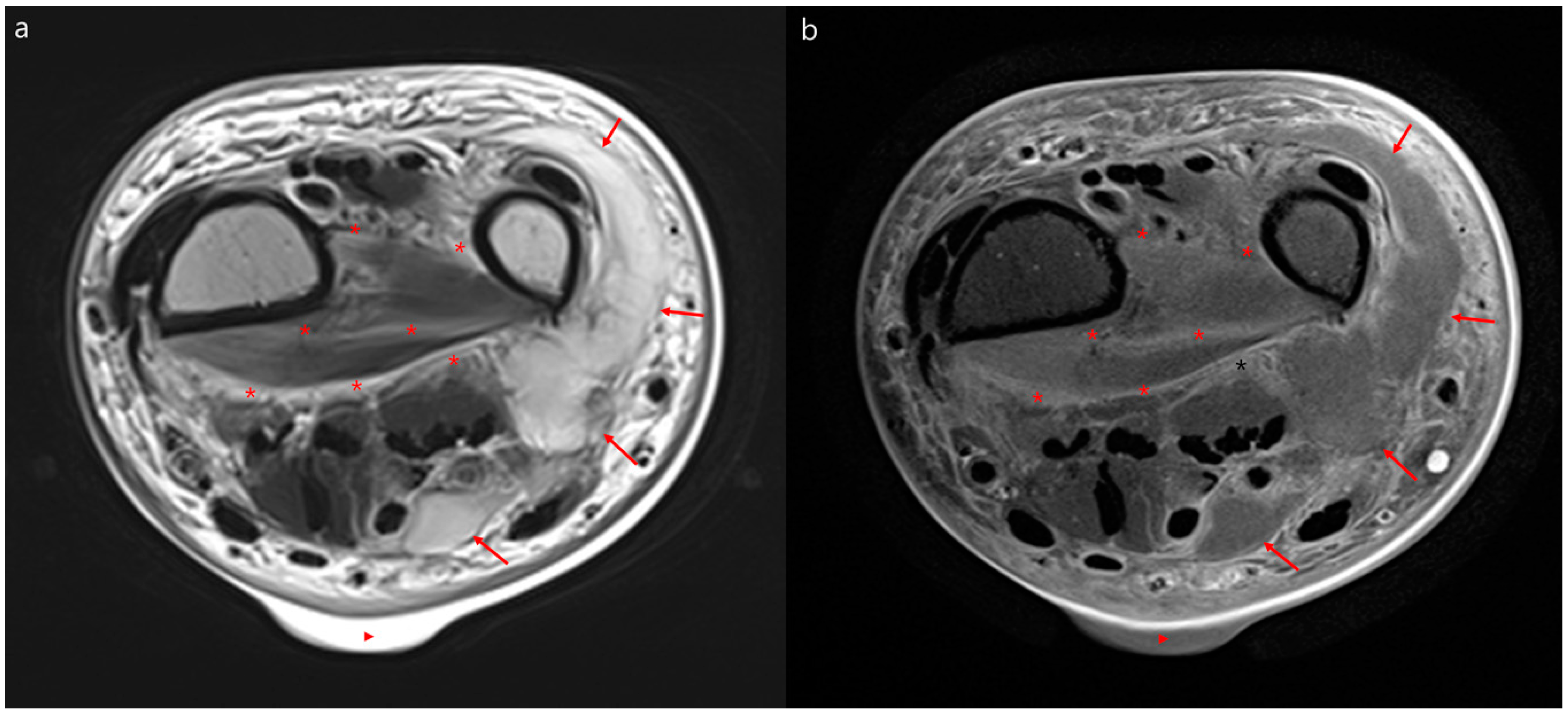 Jcm Free Full Text Utility Of Magnetic Resonance Imaging For