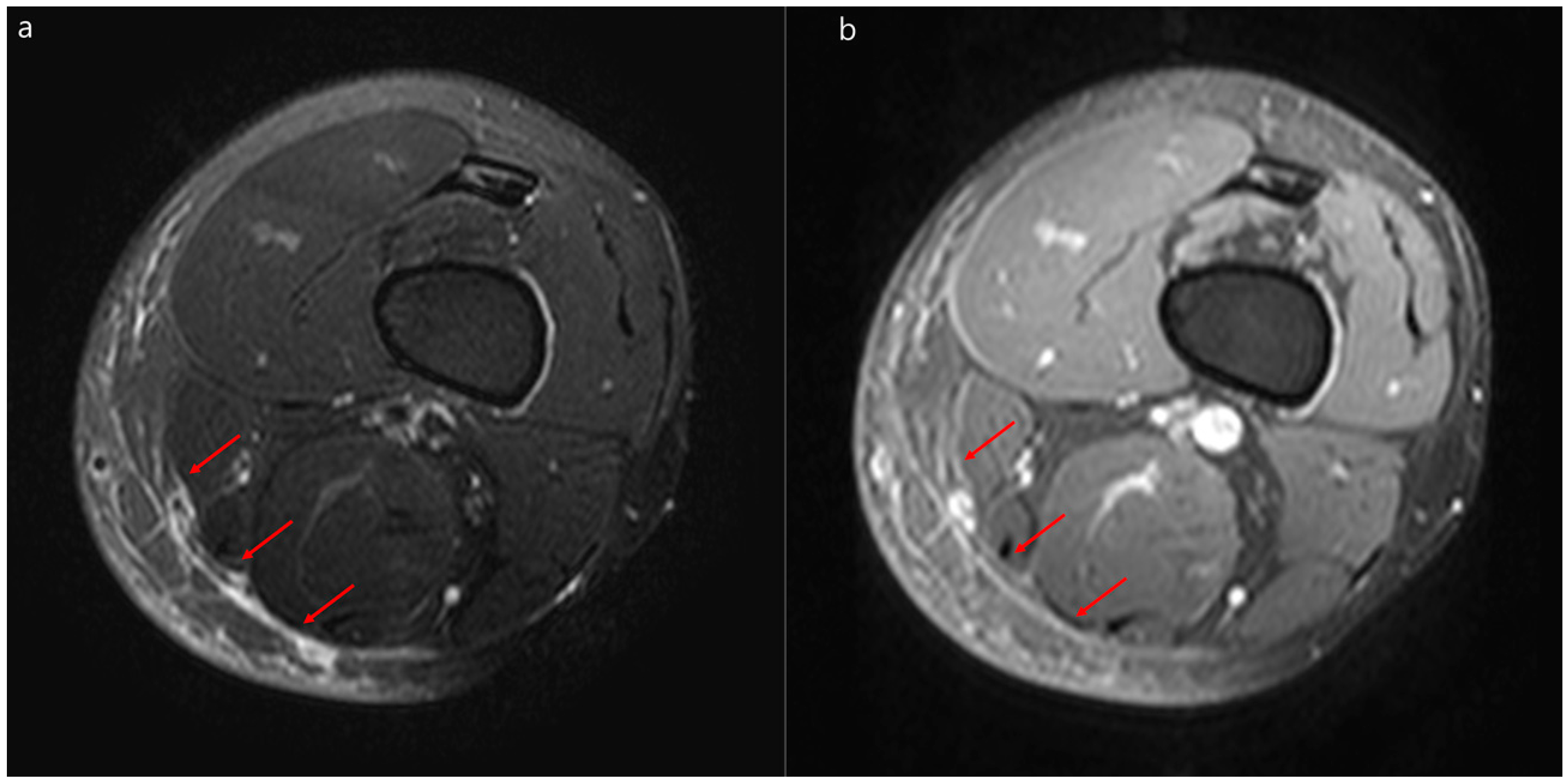 JCM | Free Full-Text | Utility of Magnetic Resonance Imaging for ...