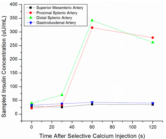 Essentials of Insulinoma Localization with Selective Arterial Calcium ...