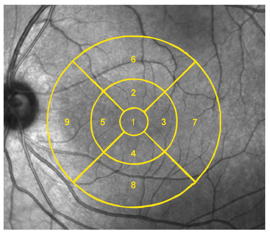 Optical Coherence Tomography Angiography of Macula and Optic Nerve in ...