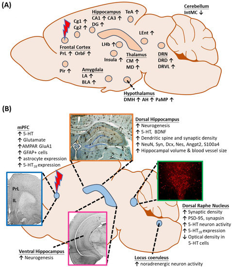 JCM | Free Full-Text | A Decade of Progress in Deep Brain Stimulation ...