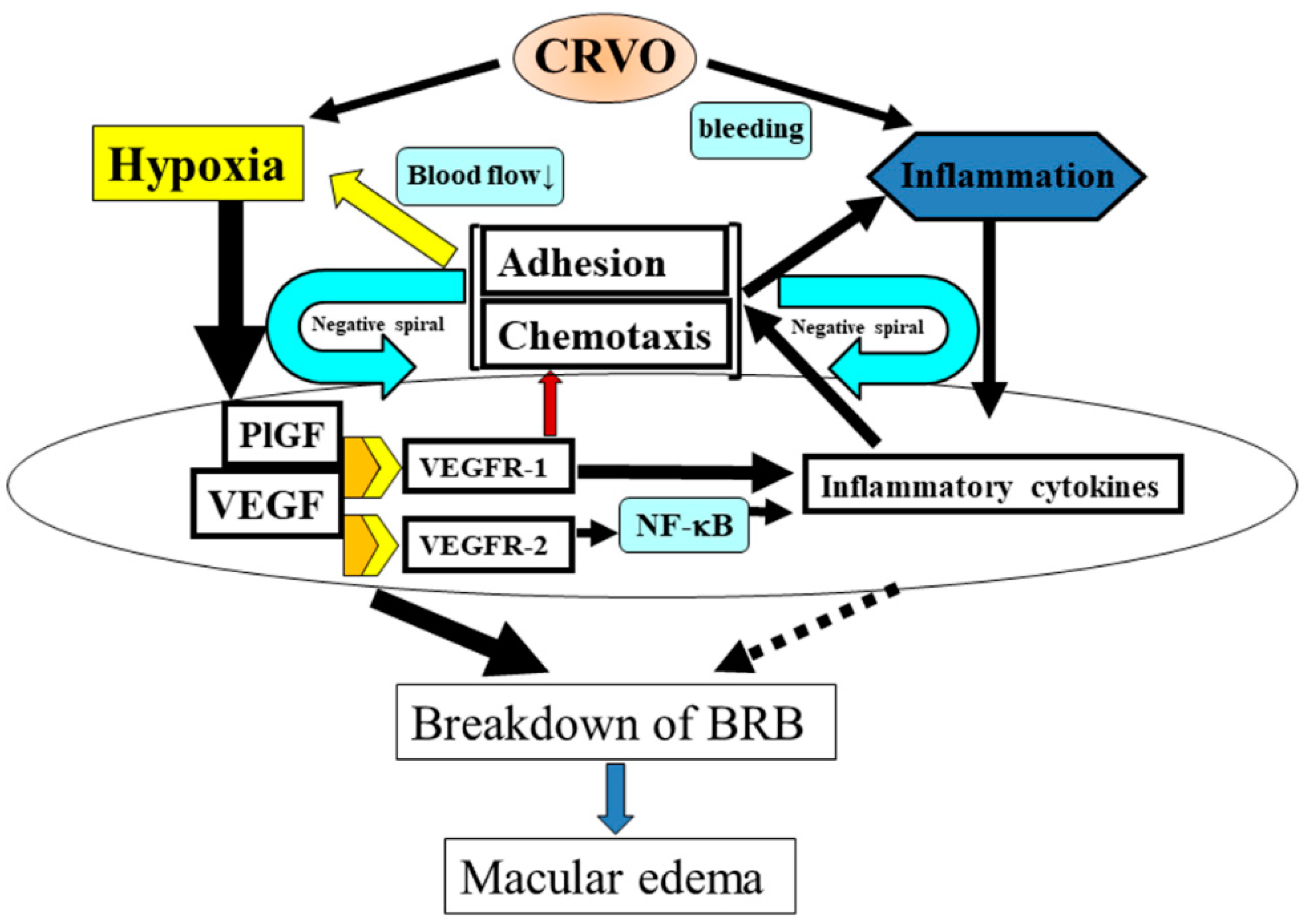 Cytokines and Pathogenesis of Central Retinal Vein Occlusion